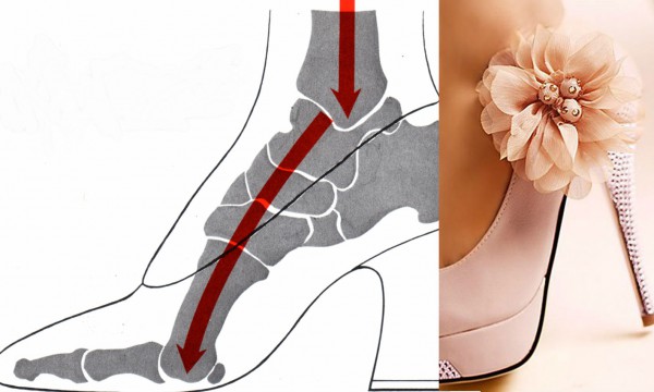 What Happens in Your Body When You Stop Wearing High Heels - Women ...