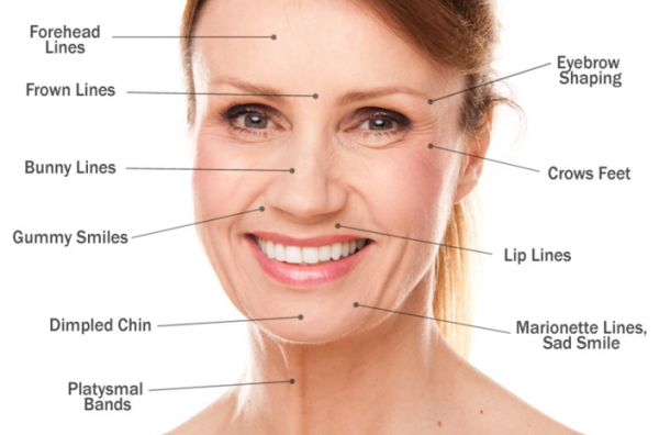 Here Is What Your Wrinkles Reveal About Your Health - Women Daily Magazine