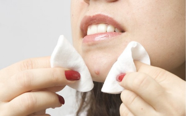 How To Properly Pop a Pimple - Women Daily Magazine