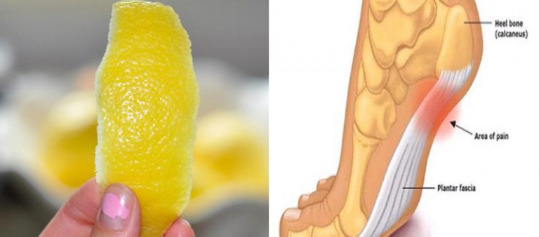 Lemon-Peel-Trick-That-Will-Help-You-Get-Rid-of-Chronic-Pain-and ...