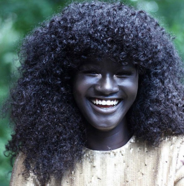 Teen Bullied For Her Extremely Dark Skin Color Becomes a Model and ...