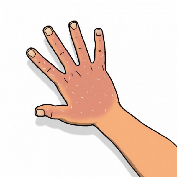What to Do When Your Hands Are Frozen From The Cold Weather - Women ...