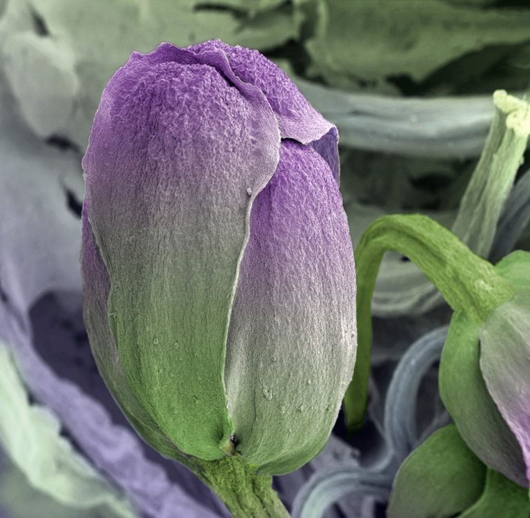 Fascinating Photos of Foods Under the Microscope That You’ve Never Seen ...