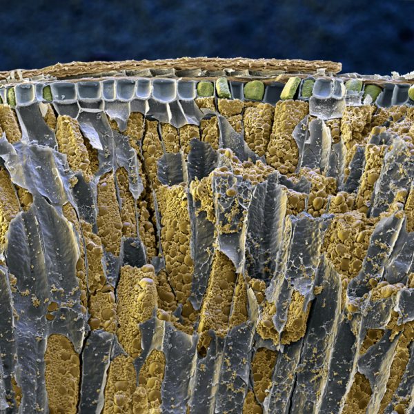 Fascinating Photos of Foods Under the Microscope That You’ve Never Seen ...