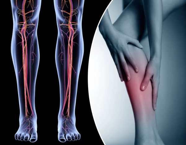 DVT Travel Tips – How to Travel Safely When Suffering From DVT - Women ...