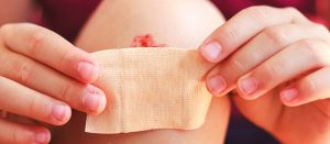 How to Care for Minor Cuts and Scrapes - Women Daily Magazine