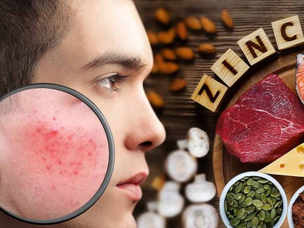 7 Things the Bad Taste in Your Mouth Is Trying to Tell You - Women ...