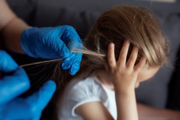Lice Myths Busted: How They Really Spread